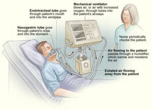 Common ICU Equipment: Your Guide to 6 Essential Tools